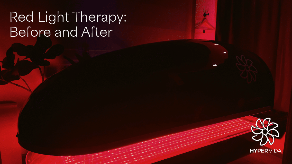 Red Light Therapy Before and After: What to Expect